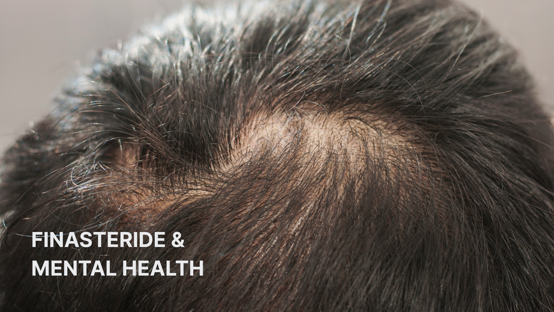 Finasteride and Suicide: The Link